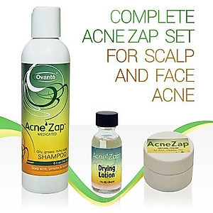 Acne Zap - Shampoo for Scalp Acne – Clear Scalp from Acne, Zits and Pimples 6.0 oz