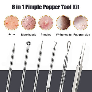 Pimple Popper Tool Kit, 6 Pcs Blackhead Remover Acne Needle Tools Set Removing Treatment Comedone Whitehead Popping Zit for Nose Face Skin Blemish Extractor Tool - Silver