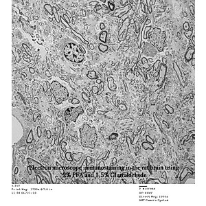 Paraformaldehyde, 4% in PBS - 500 mL - PFA04-500R