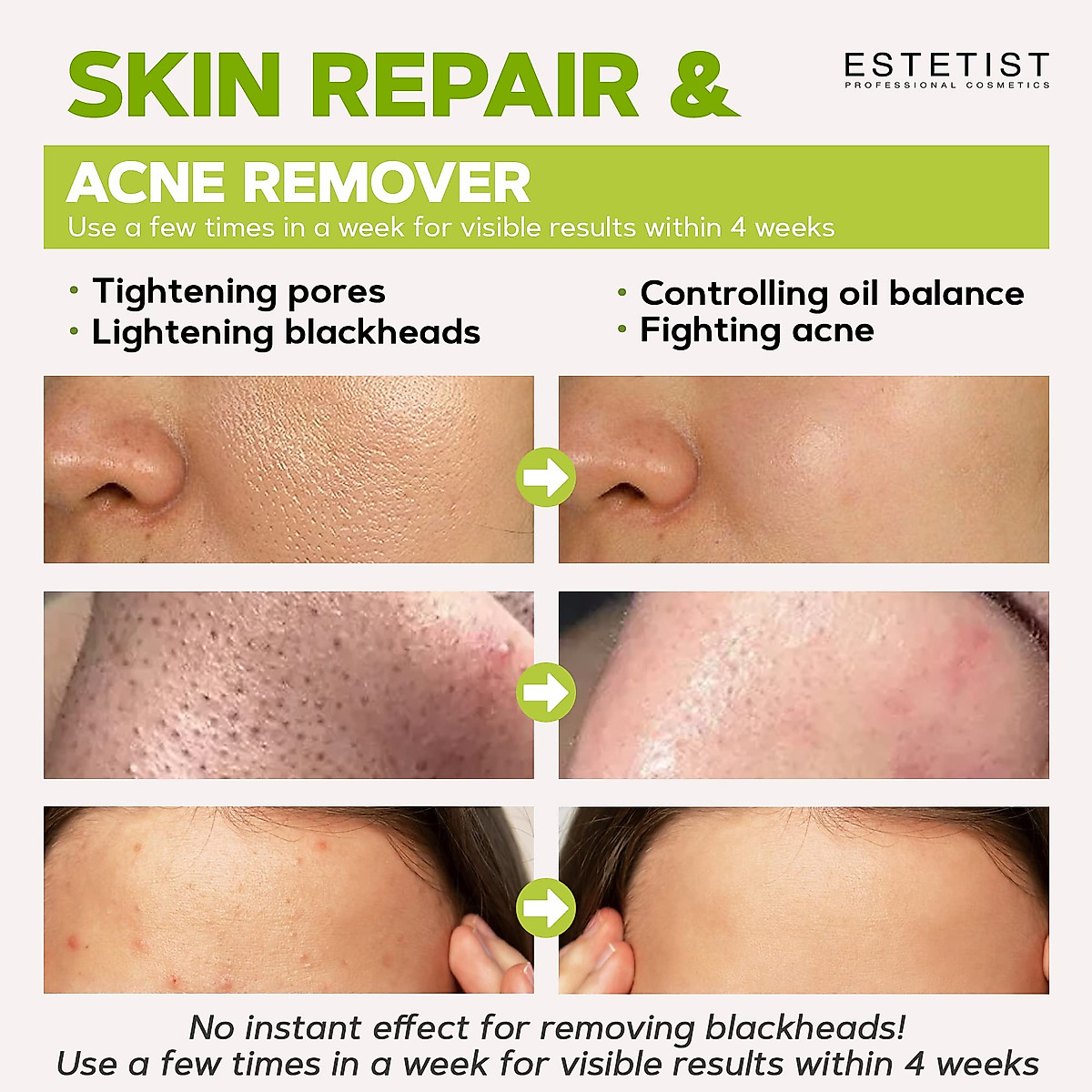 Avocado Clay Mask Stick Set Deep Pore Cleanser Blackhead Remover Replenishing Moisture Oil Control and Balance Skin Detoxifying Anti-Acne Treatment Skin Care for All Skin Types Pack of 3