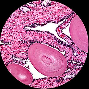 AmScope M158C-2L-PB10-WM Cordless Compound Monocular Microscope, WF10x and WF25x Eyepieces, 40x-1000x Magnification, Upper and Lower LED Illumination with Rheostat, Brightfield, Single-Lens Condenser, Coaxial Coarse and Fine Focus, Plain Stage, 110V or Ba
