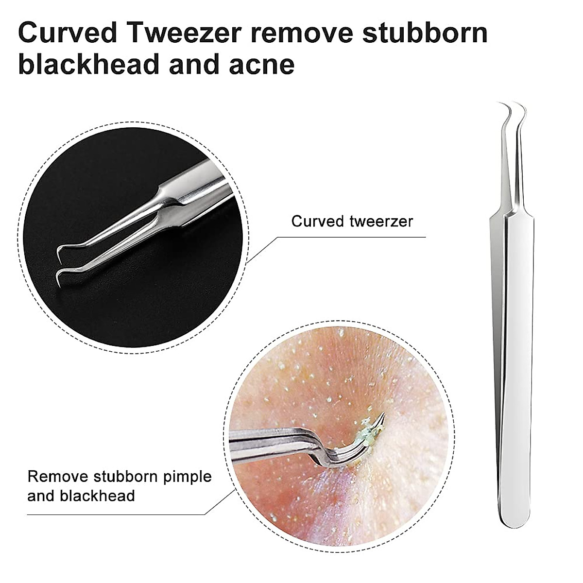 La Chat Blackhead Remover Kit - Blackhead Tweezers Removal Tool 3 pcs Comedone Pimple Extractor Tool, Acne Blemish Kit for Blackhead, pimple Tool, Curved Blackhead Tweezers kit (3 pcs)