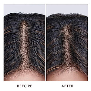 Moroccanoil Oily Scalp Treatment, 1.5 Fl Oz