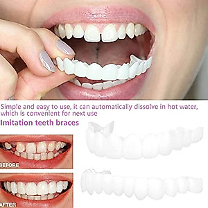CHJC 2022 New Snap-On Dentures, Veneers Snap in Teeth, Snap in Teeth for Men and Women, Fix Confident Smile