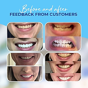 LUELLI Teeth Whitening Strips - White Strips Teeth Whitening Kit - Whiter Teeth in 7 Days Up to 10 Shades Whiter - 14 Treatments 28 Strips