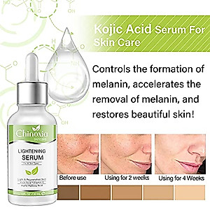 Dark Spot Corrector Remover for Face and Body, Skin Brightening Serum with Kojic Acid, Fade Dark Spots Hyperpigmentation and Melasma - 1 OZ