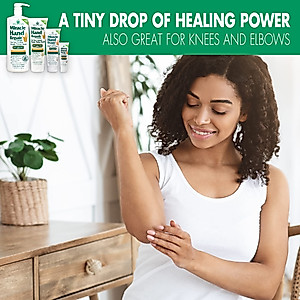 Miracle of Aloe Miracle Hand Repair Cream 8 oz Healing Aloe Vera Lotion for Dry, Cracked Hands with 60% Ultra Aloe Gel - Moisturizes, Softens, and Repairs - Non-Greasy, Lightly Scented (2-Pack)