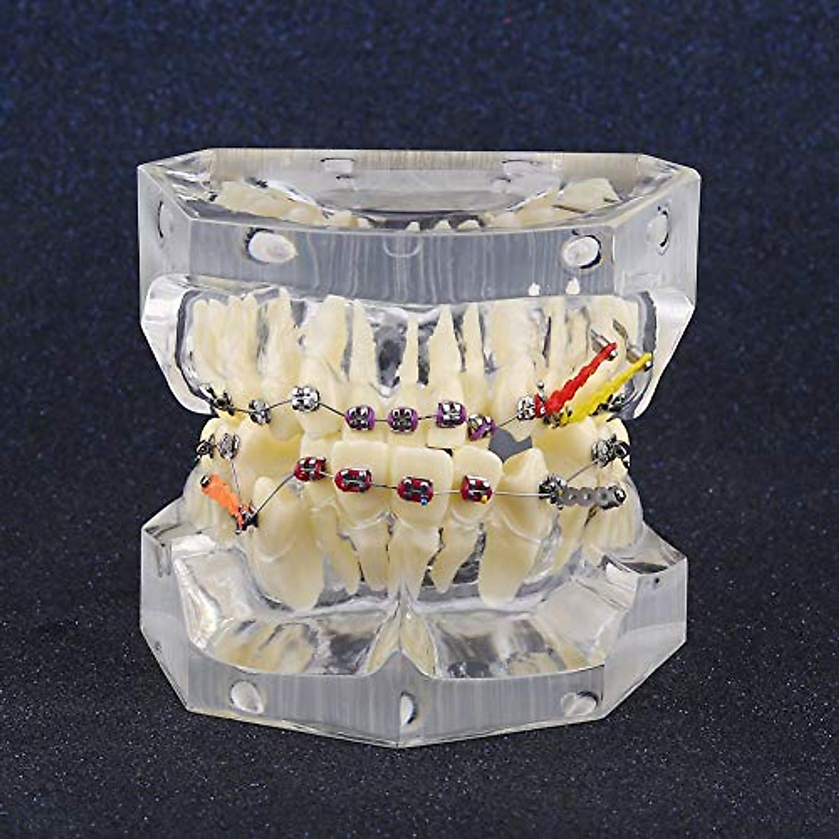 Teeth Educational Model Dental Treatment Malocclusion Study Demonstration Teeth Model with Wire Chain Orange