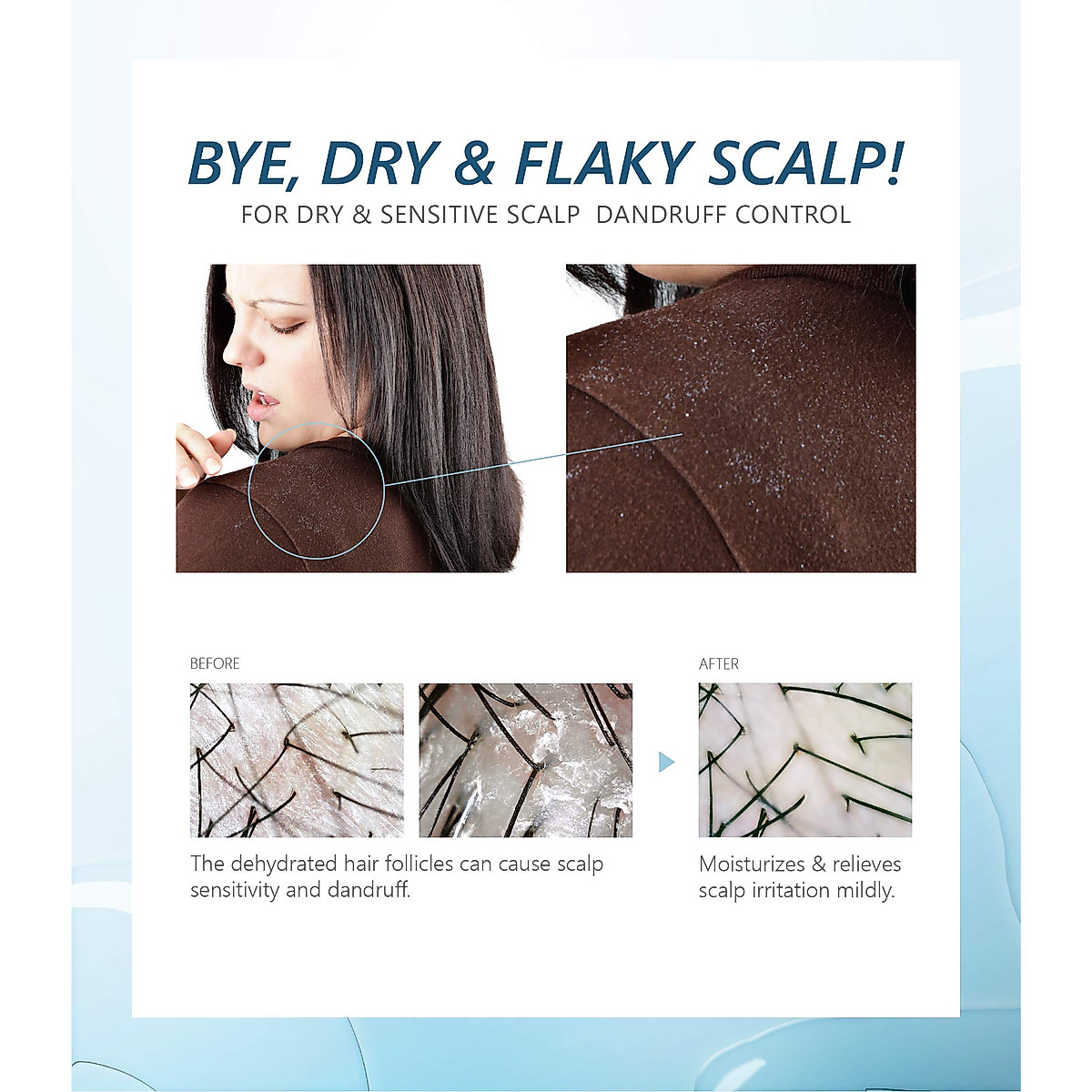 Aromase Dry and Dry Dandruff Solution Kit (5α Juniper Scalp Purifying Liquid Shampoo 2.8 Fl Oz + Dry and Sensitive Solution Shampoo 14 Fl. Oz) for Very Dry Scalp, Dry Dandruff