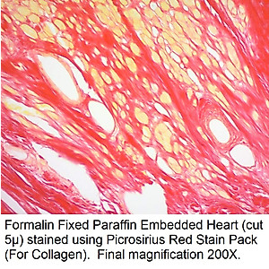 Picrosirius Red Stain Pack (for Collagen), 500ml