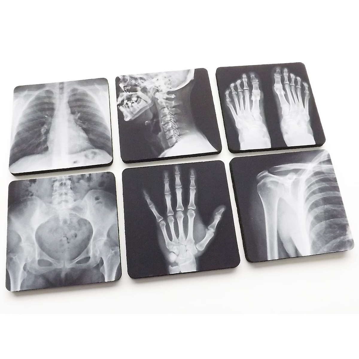 Radiology Drink Coasters Set of 4 or 6 Neoprene or Hardboard Xray Tech Imaging Radiologist Graduation Gift Doctor Nurse