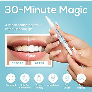 Venus Visage Award Winning Teeth Whitening Pen, 20+ Uses - Teeth whitening Gel Professionally formulated - Best Teeth whitening Gel Pen Teeth Whitener - Low Sensitivity (Mint) (0.07 Fl Oz (Pack of 2))