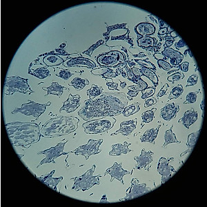 Prepared Animal Plant Cell Mitosis Meiosis Amitosis Comparison Microscope Slides Set, 5pcs Specimens to Display with Students in Biology Class (Mitosis & Meiosis)