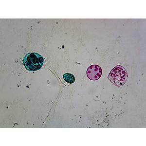 Volvox, Sexual Reproduction - Microscope Slide