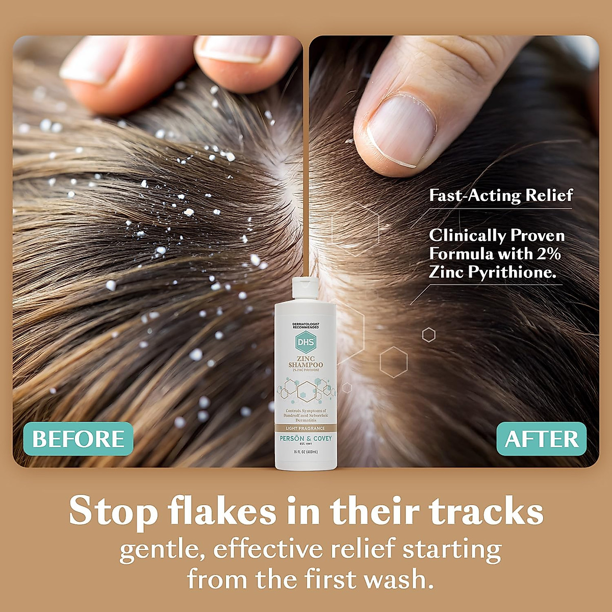 Zinc Shampoo, Dhs 16oz