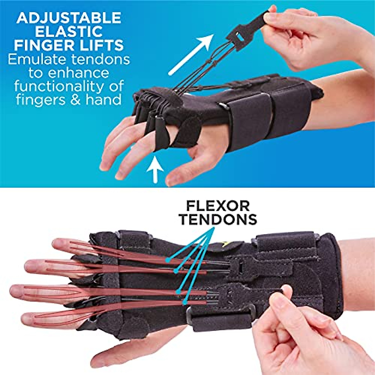 BraceAbility Radial Nerve Palsy Splint - Dynamic Wrist Drop and Limp Finger Extension Brace for Saturday Night, Honeymoon, and Crutch Palsy Treatment (One Size)