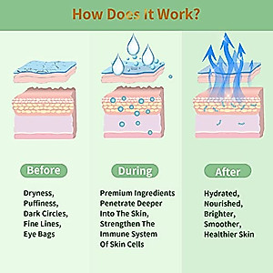 Under Eye Patches for Puffy Eyes Treatment 24 Pairs, 24K Gold Under Eye Masks for Dark Circles and Puffiness, Eye Gel Pads w/Collagen, Hyaluronic Acid, Rose Essence, Vitamins for Eye Bags Treatment