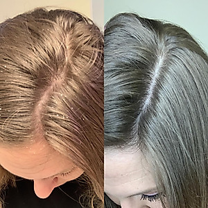 L'ANZA Healing Remedy Scalp Balancing Leave-in Treatment, Restores, Revives, and Nourish Hair & Scalp, Promotes Healthier Hair Growth, Thickness and Density (3.4 Fl Oz)