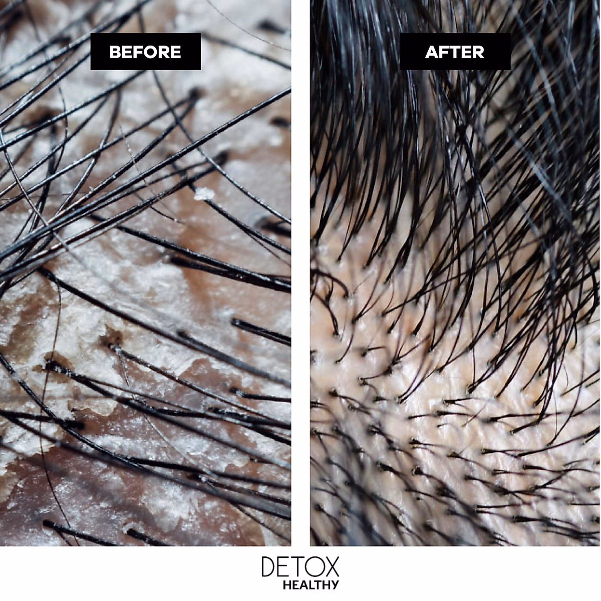 YBERA PARIS Professional Detox Healthy DUO | Refreshing Care for Oily | Prevent Hair Loss | Stimulate Growth & Improve Damaged Hair | Shampoo 8.4 Oz & Conditioner 8.8 Oz