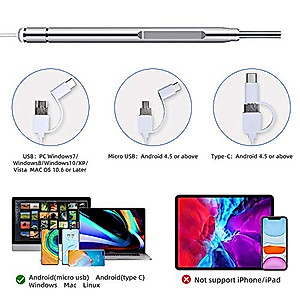 Cainda Otoscope USB Ear Camera, Ear Wax Removal Endoscope with Light for Android Phone Window and Mac PC (Not for iPhone), Digital USB Camera with Ear Cleaning Earwax Removal Tool