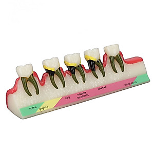 Natudeco Tooth Model Oral Care Model Denture Kit Strong Durable And Convenient. Teachers Use Order Remarks Product Box Plus Buffer Cotton Delivery