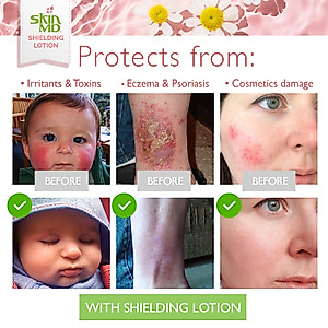 Skin MD Shielding Lotion - Hydrating Body Lotion for Sensitive Skin | Non-Greasy, Fast-Absorbing Moisturizer with Plant-Based Ingredients | for Dry Skin, Eczema & Psoriasis Relief - 16oz Dispenser