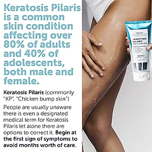 KP Bump Eraser Body Scrub, Keratosis Pilaris Treatment, Strawberry Legs Treatment for Women, Bump Eraser Body Scrub, Keratosis Pilaris, Body Scrub for Strawberry Legs