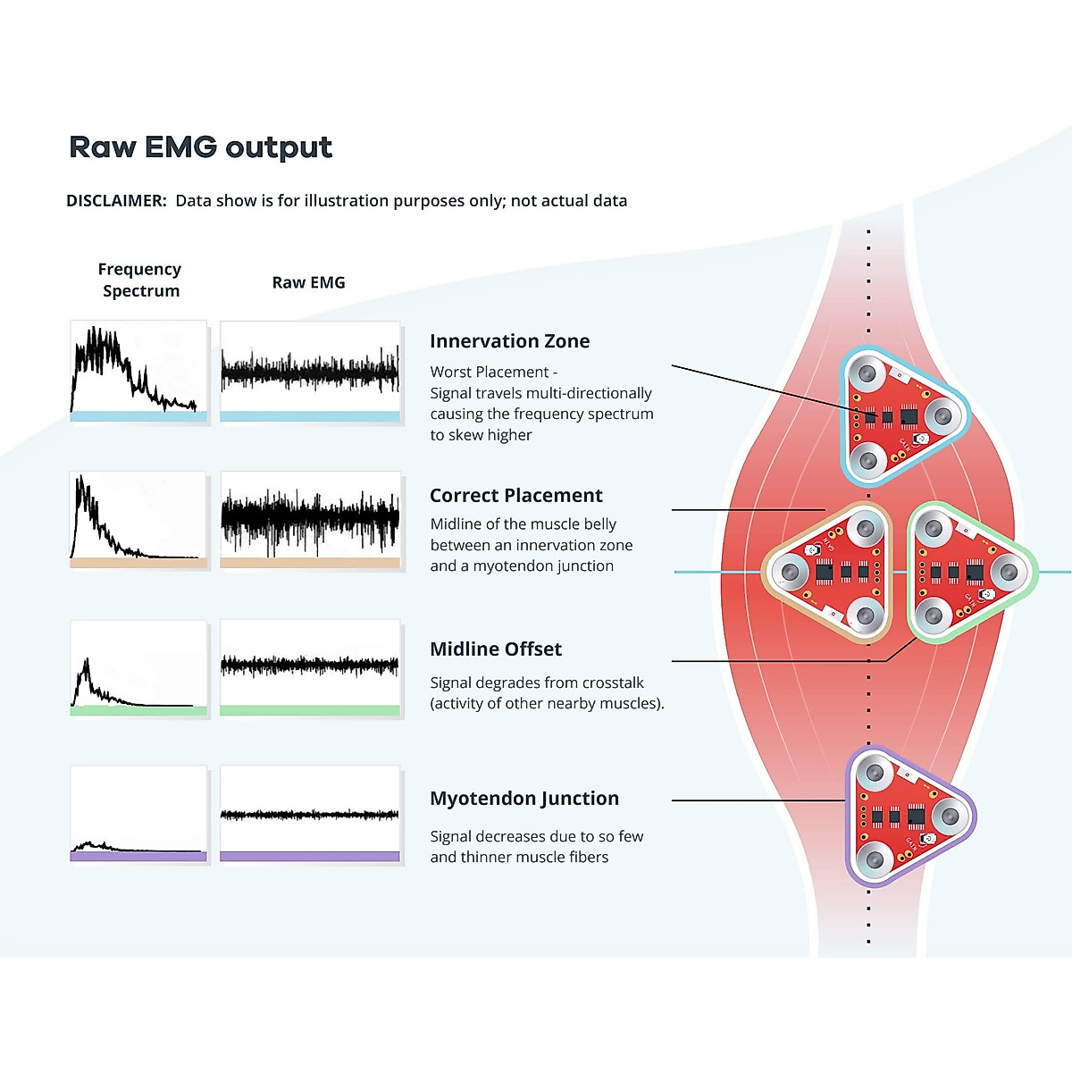 MyoWare 2.0 Muscle Sensor-Compatible with Arduino- All-in-one electromyography (EMG) sensor from Advancer Technologies -Measure muscle activity by detecting its electric potential-Keyed Snap Connector