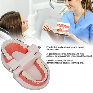 Typodonts Orthodontics Demonstration Model, Dental Orthodontic Model with Metal Wires and Bracket Teaching for Adults and Children Learning