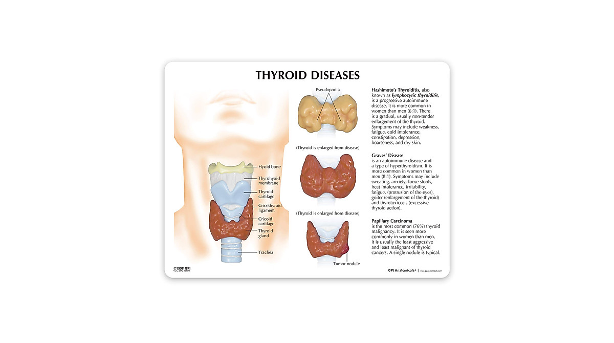 Thyroid Model Set – Accurate Anatomy for Medical Education & Patients