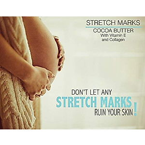 Lawrens Strech Marks Cocoa Butter with Vitamin E and Collagen - Minimizes Apperence of Stretch Marks - Moisturizes skin - 16 oz