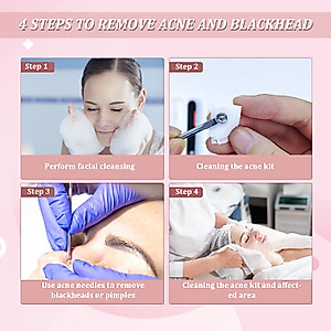 4PCS Blackhead Acne Removal Extractor, Curved Blackhead Tweezers Kit, Professional Stainless Pimple Acne Blemish Removal Tools Kit with Storage Box