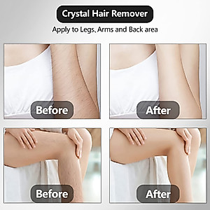 Crystal Hair Eraser,Magic Crystal Hair Remover for Men&Women-Painless Soft Smooth Silky Skin Crystal Hair Removal for Arms,Legs and Body,Fast&Easy Exfoliate (Black)
