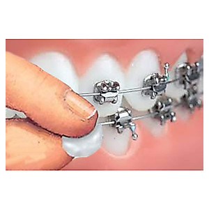 Genuine Orthowax - Orthodontic Wax for Braces Wearer - Stick Better Than competitors