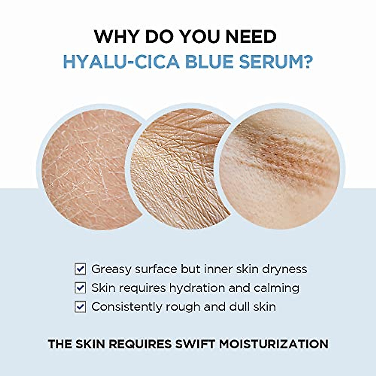 SKIN1004 Hyalu-CICA Blue Serum 1.69 fl.oz(50ml) | 5 Layer Hyaluronic Acid Cica Niacinamide | Hydrating and Refreshing Multi-Care Solutions