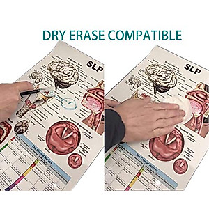 Tooth Repair Poster, Chart (PVC, Large 24x36)