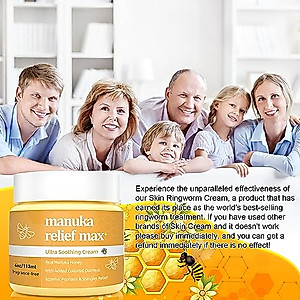 Eczema Psoriasis Manuka Relief Honey Cream, Hand Foot, Tinea Versicolor, Itchy Feet, Butt, Anal Itch, Scalp Dandruff, Bee Sting, Bites, Boil Cyst, Armpit, Adults Kids, Natural Organic Soothing