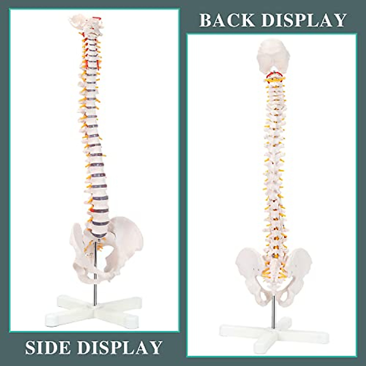 RONTEN Spine Model, 31" Life Size Spinal Cord Model with Vertebrae, Nerves, Arteries, Lumbar Column and Male Pelvis - Mount on a Stand