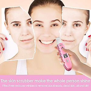 Skin Scrubber,Blackhead Remover Pore Cleaner Skin Scrubber