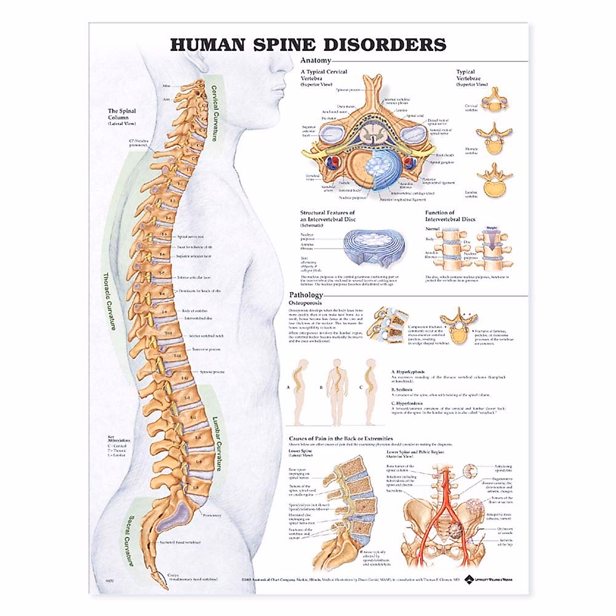 Anatomical Chart Company Human Spine Disorders Chart