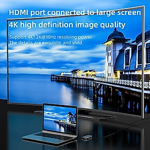 USB C Hub 10 in 1, USB-C Laptop Docking Station, USB C to HDMI Adapter for MacBook and Windows with 4K HDMI VGA Ethernet PD 3.0 USB Audio RJ45 TF/SD