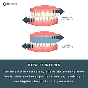 CUSTMBITE Premium Hard Surface Night Guards for Teeth Grinding, 2 Pack with Mouth Guard Case, USA Made, Mouth Guard for Clenching Teeth at Night, Bruxism NightGuard - Customizable Fit Dental Guard