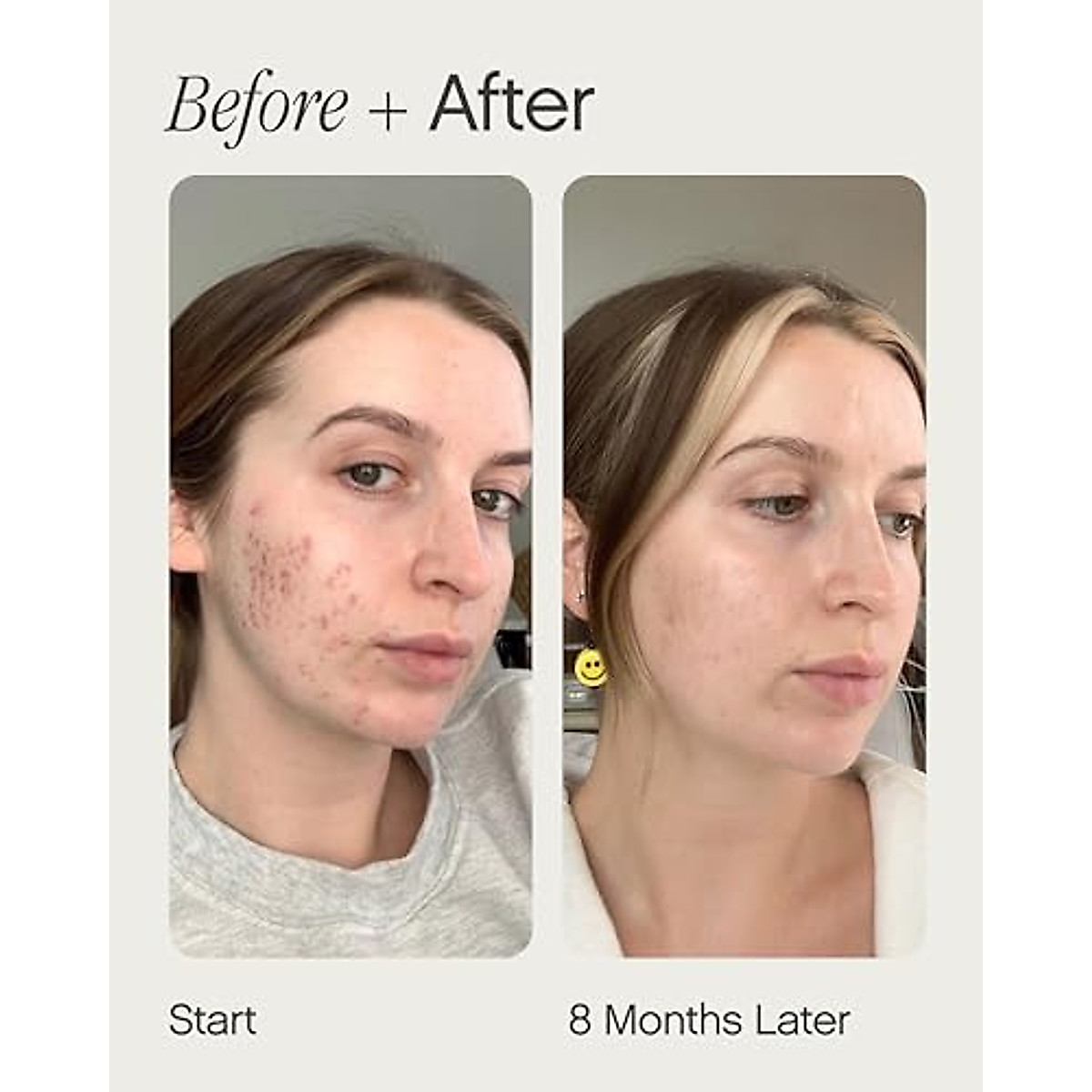 Topicals Faded Skin Serum for Dark Spots and Discoloration - Hyperpigmentation Safe - Tranexamic Acid and Niacinamide for Post-Blemish Marks, Scars and Spots (1.7 Fl Oz)