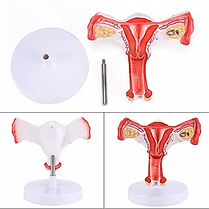 XKiss Human Uterus and Ovary Model, Female Reproductive Organ Model, Life Size Uterine Medical Educational Tool for Anatomical Gynecology Doctor Patient Communication Simulation