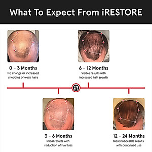 iRestore Professional Laser Red Light Therapy for Hair Growth System - FDA Cleared Hair Loss, Hair Thinning & Alopecia Treatment for Men & Women - Laser Cap for Hair Regrowth - 282 Lasers & LEDs