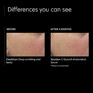 PCA SKIN Vitamin C Quench Antioxidant Protective Face Serum - Anti Aging Hydrating Facial Corrector with Hyaluronic Acid for Fine Lines & Wrinkles, Recommended for Oily & Acne-Prone Skin (1 fl oz)