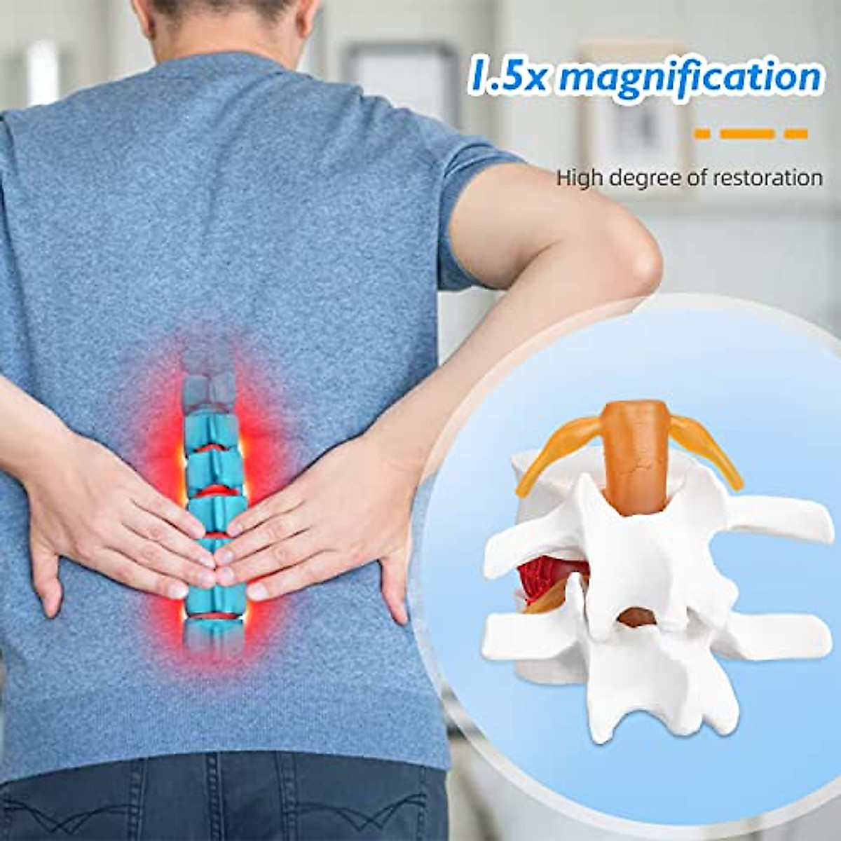 faruijie Disc Herniation Model - 1.5X Lumbar Herniated Disc Model Vertebral Spine Anatomical Medical Model