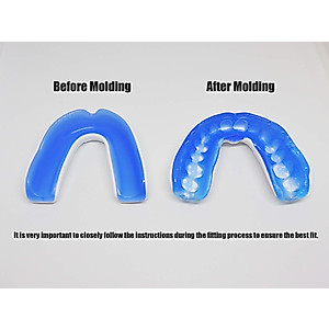 COOLLO SPORTS Boil and Bite Mouth Guard (Youth & Adult) DA Custom Fit Sport Mouthpiece for Football, Hockey, Rugby, Lacrosse, Boxing, MMA (Free Case Included!) (Mint Green & Black, Ages 10 & below)