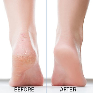 Pumice Stone - Callus Remover and Foot Stone Scrubber - Exfoliating Foot Stone Pumice Rock for Hard, Dry and Dead Skin on Heels, Body, Feet (Pack of 2) (White)