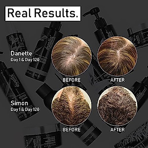 évolis Promote Nourishing Shampoo | Shampoo for Hair Growth and Longer, Stronger Hair | Sulfate Free| Hair Protein Strengthening Shampoo with Keratin and Wheat Protein Bond (8.5 Fl Oz)